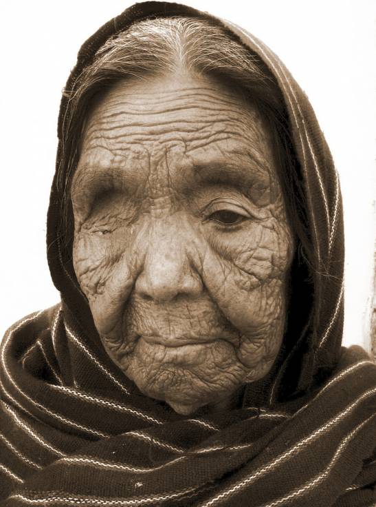 Caracterizan una de las proteínas con las que el virus de la viruela ...