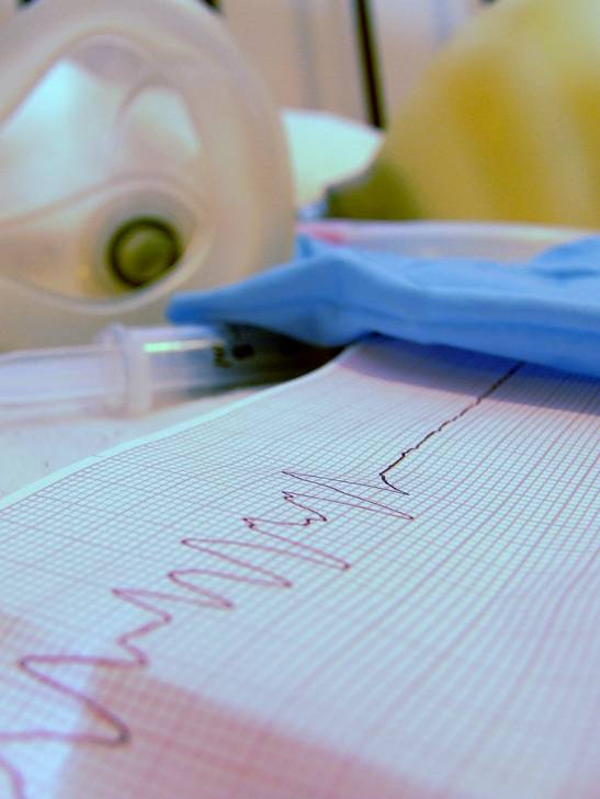 Un método físico se adentra en el bombeo del corazón