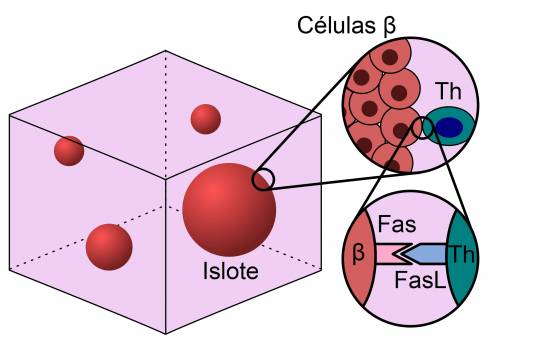 Diagrama De Diabetes Tipo 1 Pancreas Diabetes Tipo 1 Y 2